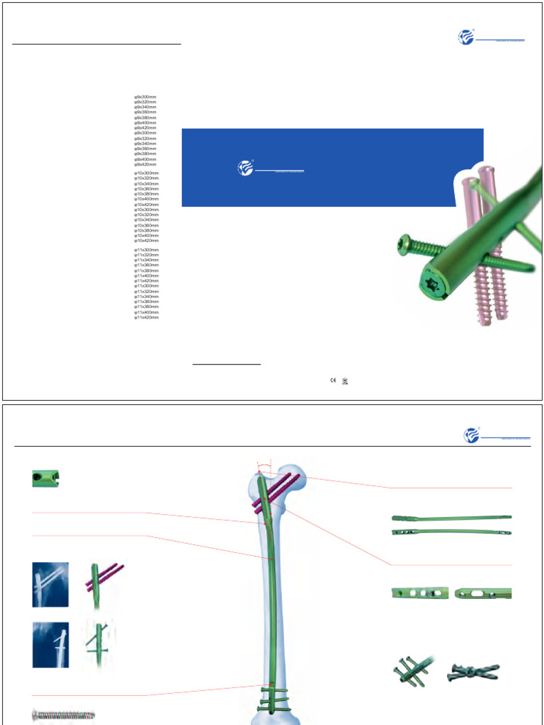 De-wi-pi-En-005-Pm A0 Universal Femoral Nail (Ufn) II | PDF | Screw ...