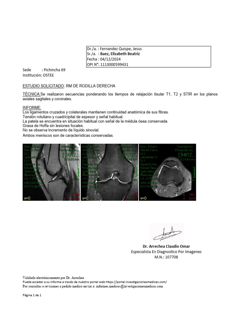 Informe RM Rodilla Derecha - OSTEE | PDF