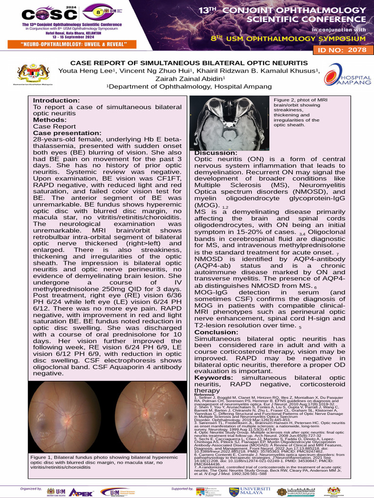 Case Report of Simultaneous Bilateral Optic Neuritis | PDF | Multiple Sclerosis | Diseases And ...