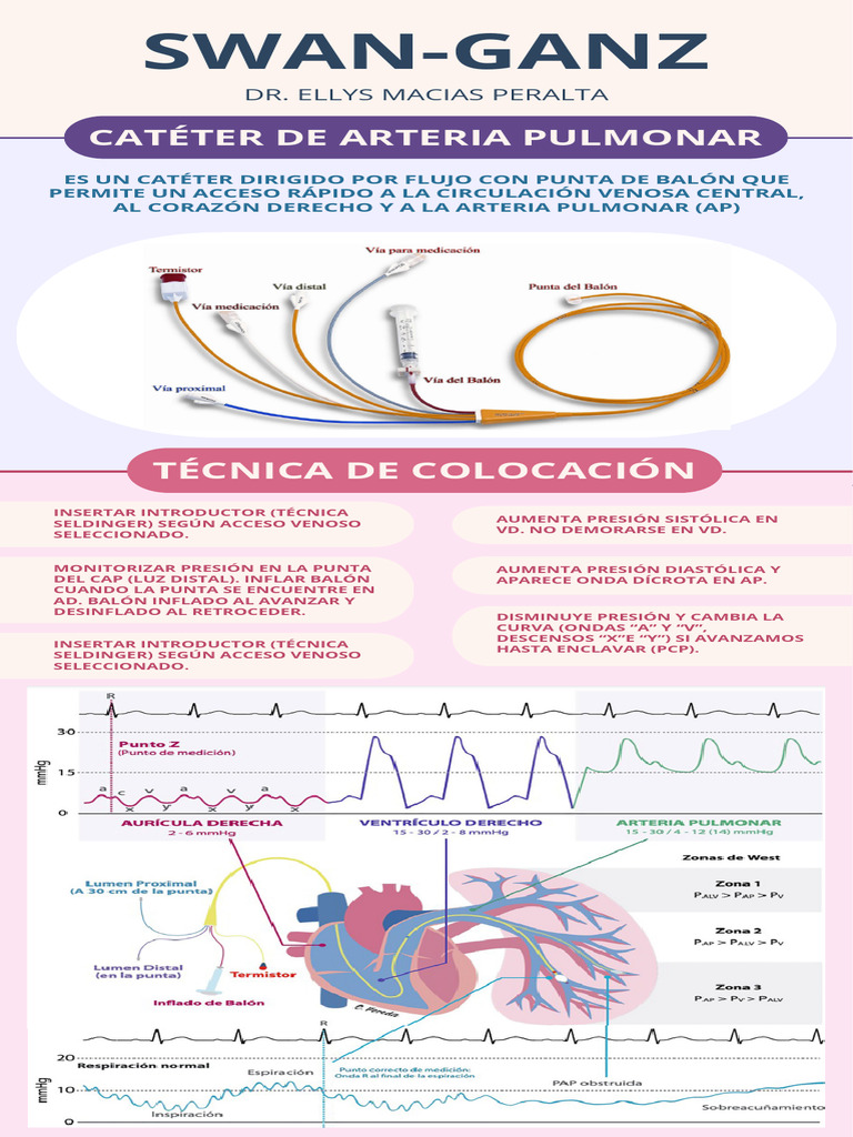Cateter de La Arteria Pulmonar Swan-ganz - Dr Ellys Macias Peralta | PDF