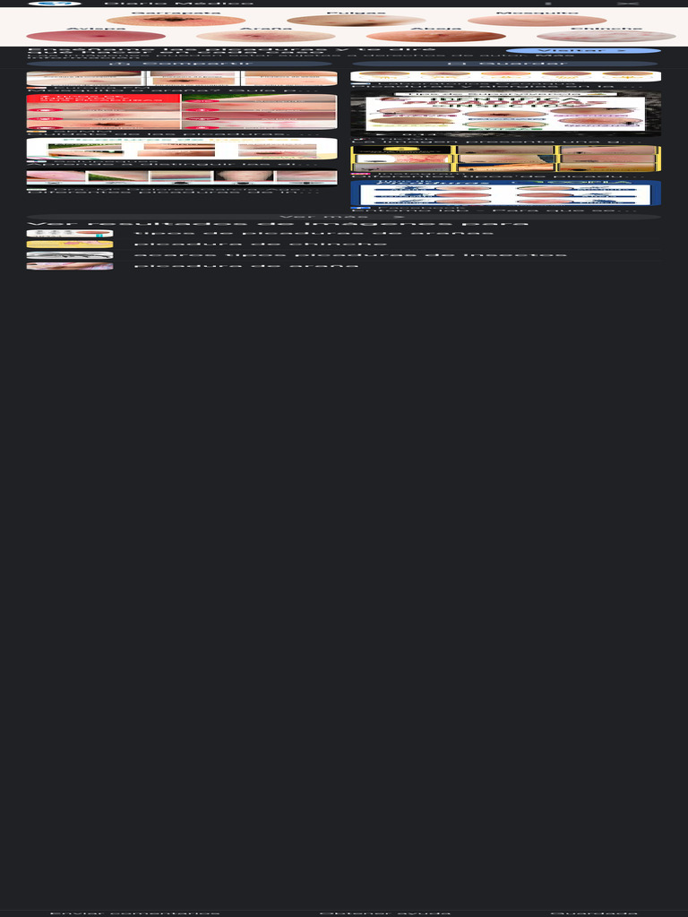 Tipos de Picaduras en la Piel | PDF