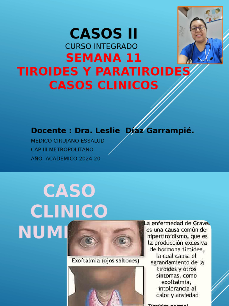 11 Semana Presentacion Clase y Casos Clinicos Tiroides y Paratiroides | PDF | Hipertiroidismo ...