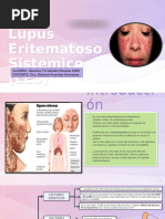 Diagnóstico y manejo del lupus eritematoso | PDF | Medicina CLINICA ...