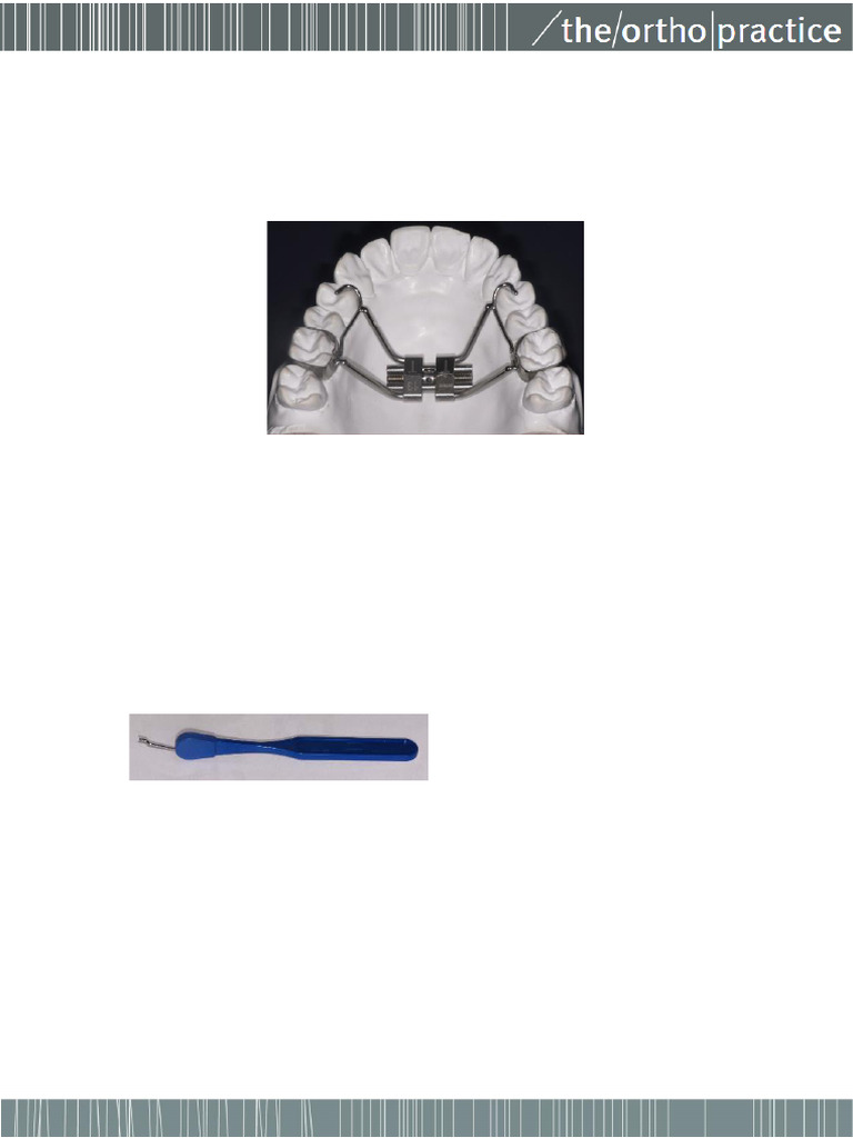 RME Instructions for Jaw Expansion | PDF