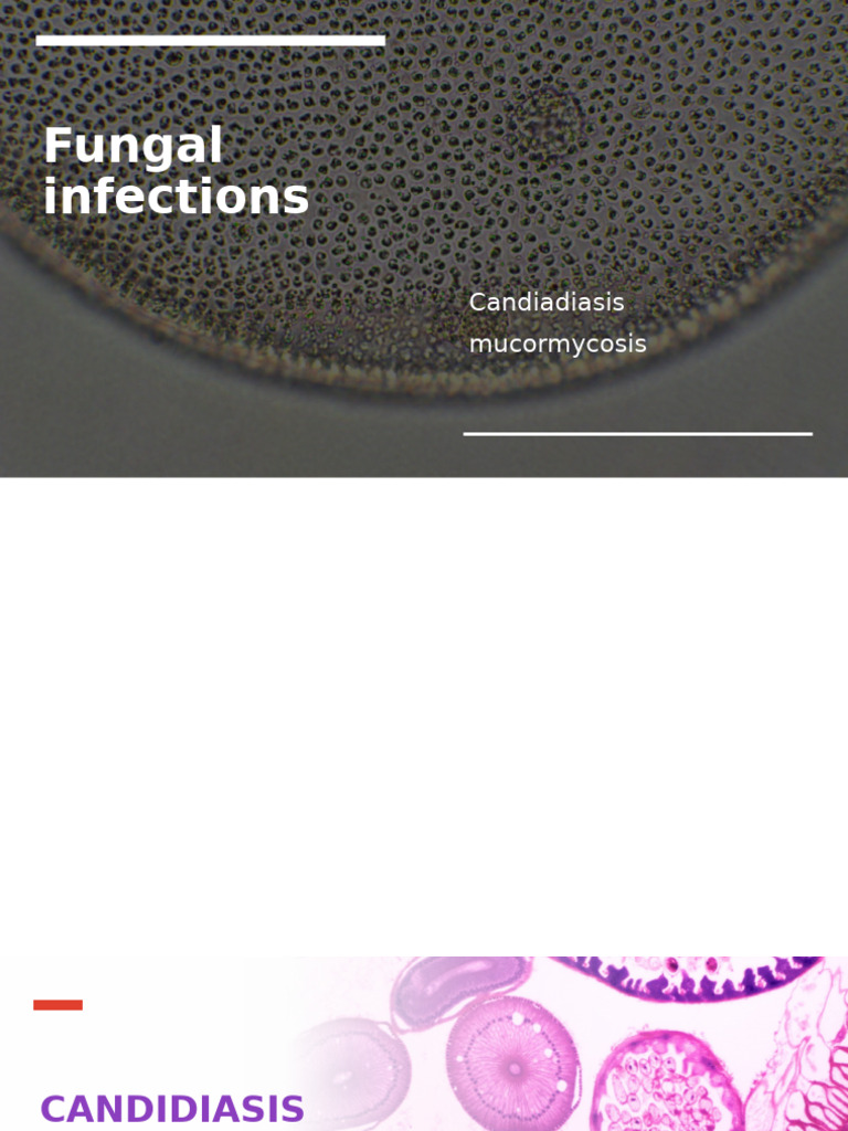 Candidiasis | PDF | Candidiasis | Candida (Fungus)