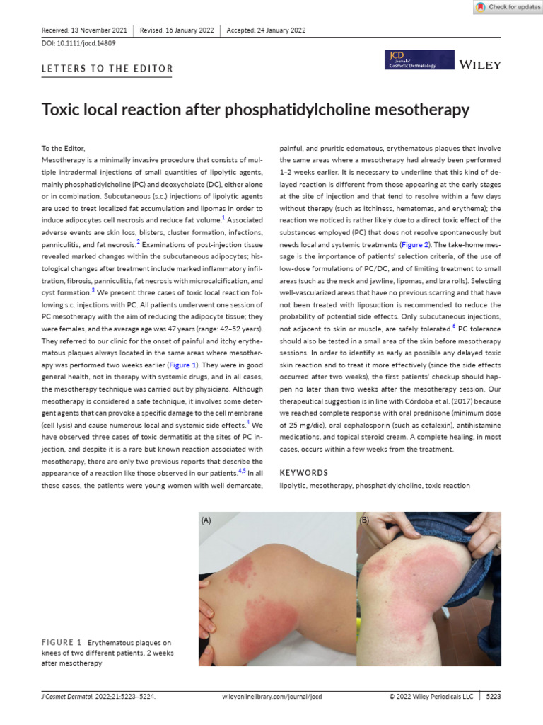 932-BR [2022JCD]Toxic local reaction after phosphatidylcholine ...