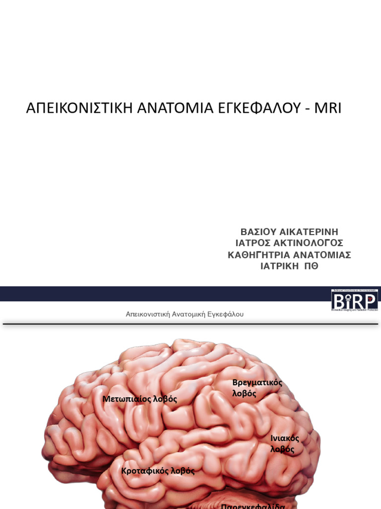 Απεικονιστικη Ανατομια Εγκεφαλου Mri 2023 | PDF