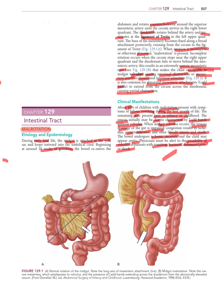 Congenital Intestinal Anomalies | PDF | Inflammatory Bowel Disease ...