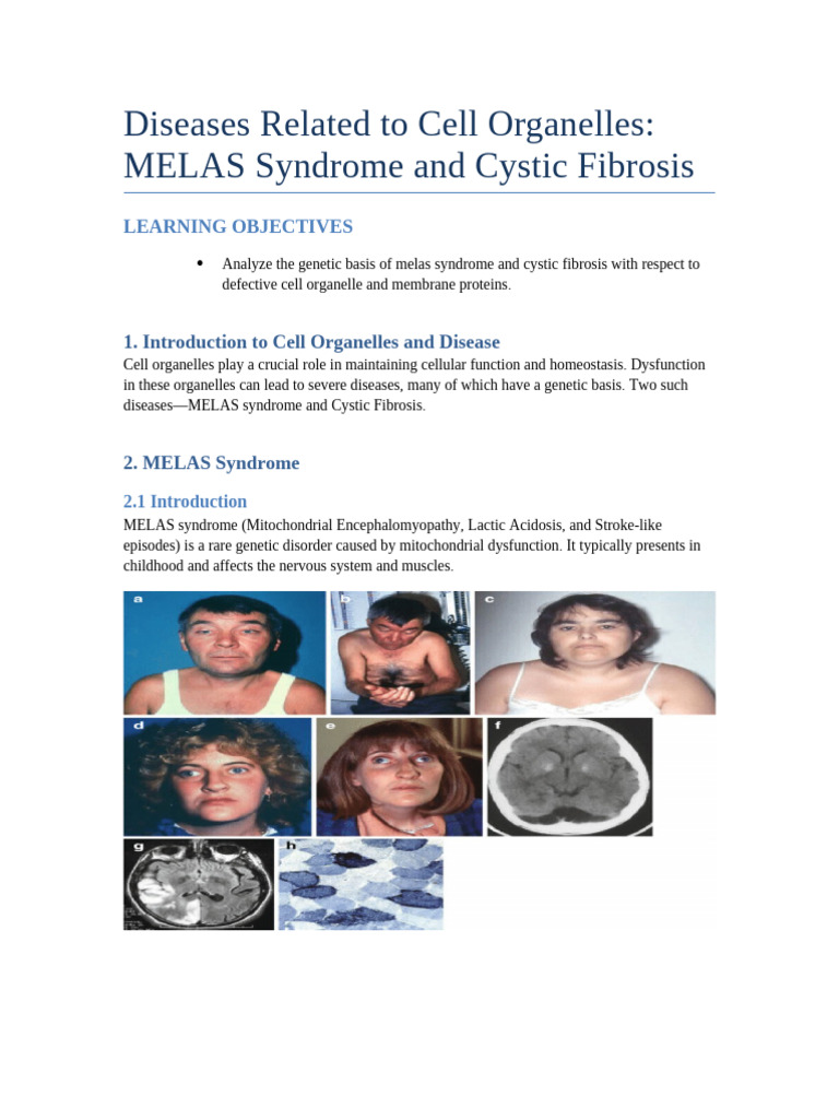 MELAS Syndrome & Cystic Fibrosis Overview | PDF | Mitochondrion ...