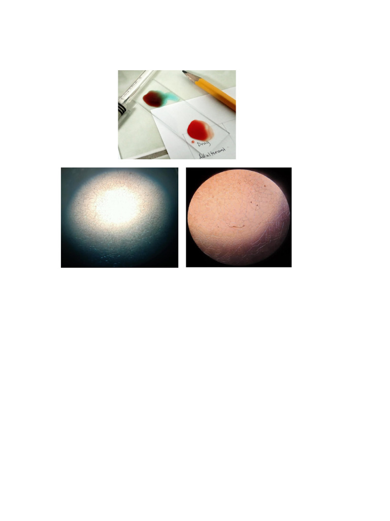 Toxicology Blood Typing | PDF