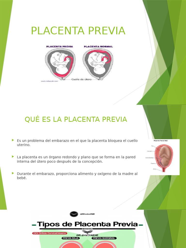 Placenta Previa | PDF