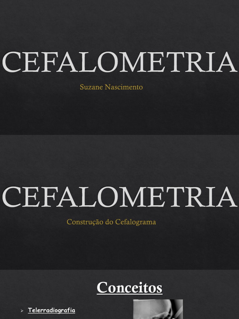 Cefalometria: Análise e Aplicações | PDF | Crânio | Anatomia