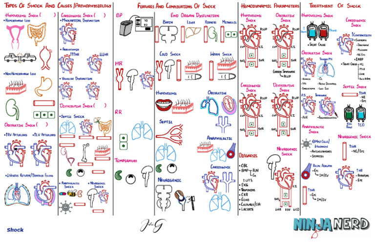 Cardiovascular Pathology - 030) Shock Hypovolemic, Cardiogenic ...