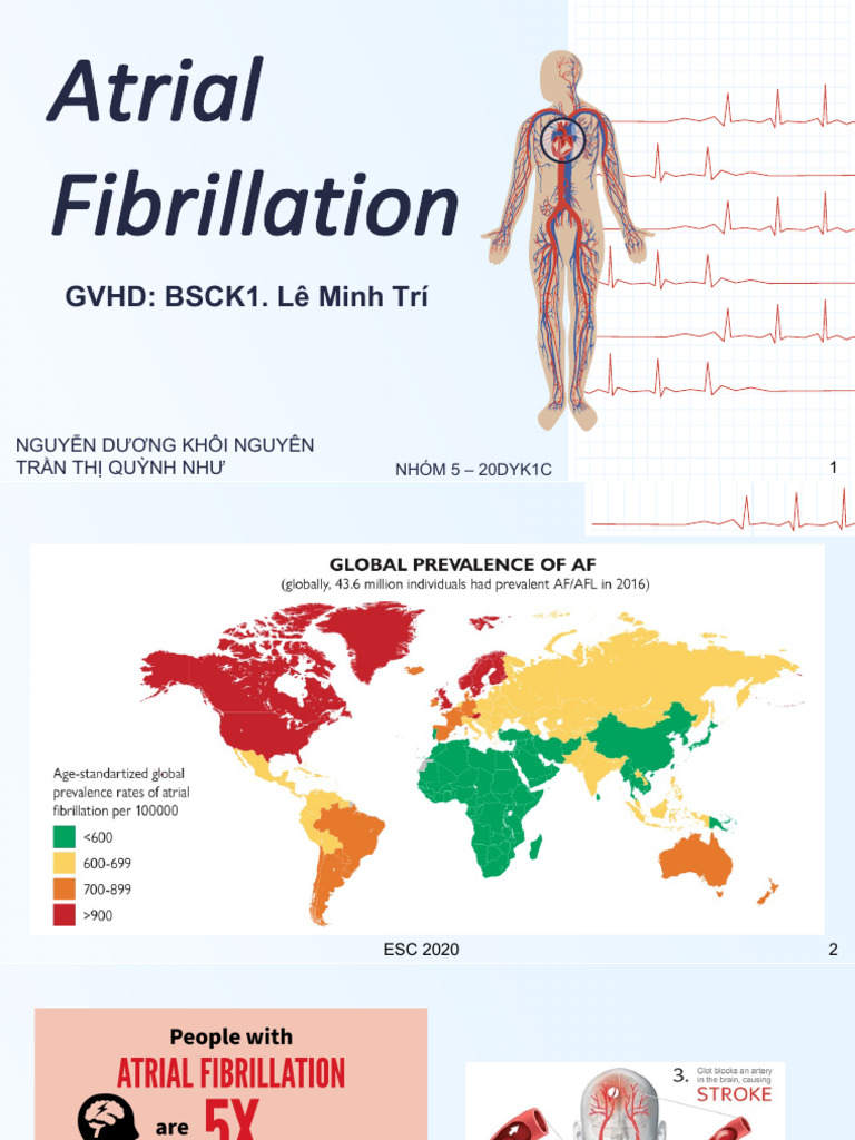 Atrial Fibrillation | PDF
