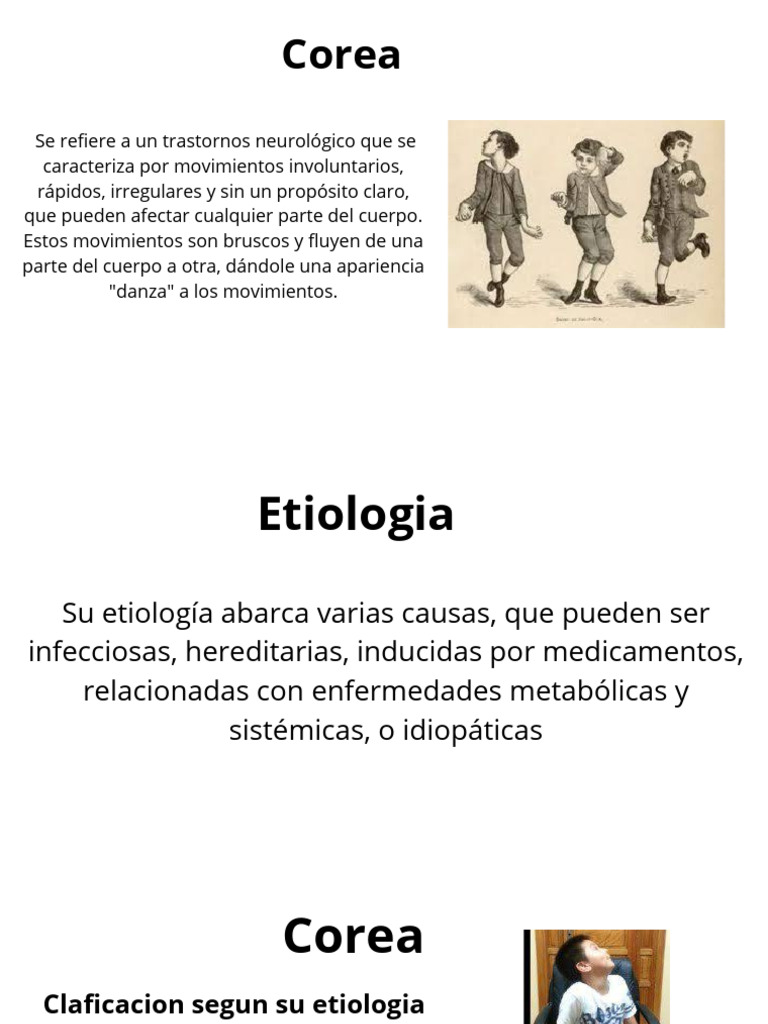 Movimientos Coreicos: Tipos y Tratamientos | PDF