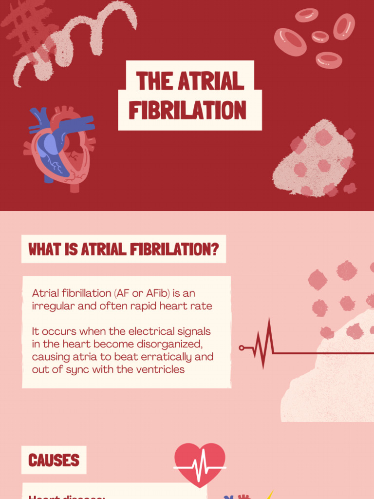 The Atrial Fibrilation (1) 2 | PDF
