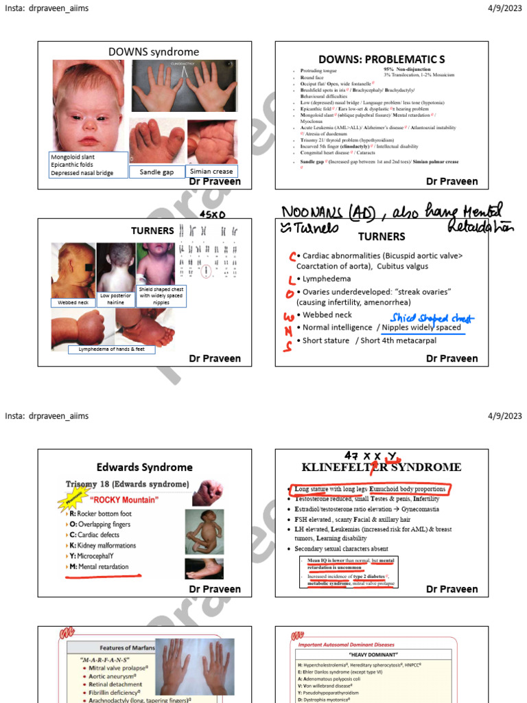 Genetic Syndromes Overview by Dr. Praveen | PDF | Down Syndrome | Medical Specialties