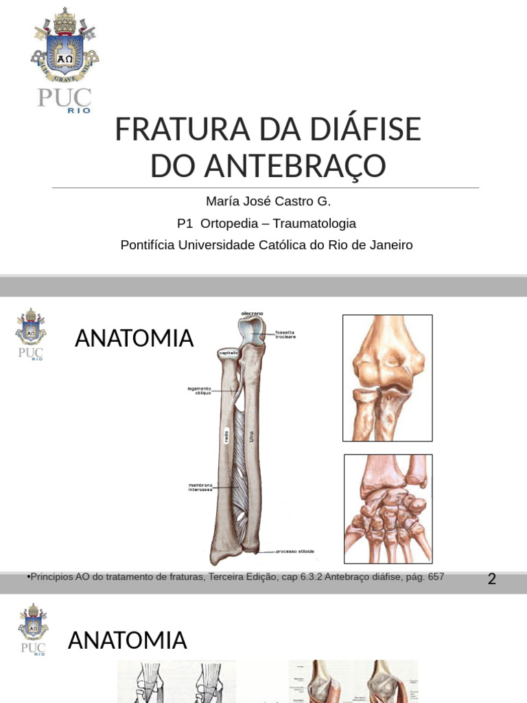 Fratura da Diáfise do Antebraço: Guia Completo | PDF | Doenças e ...