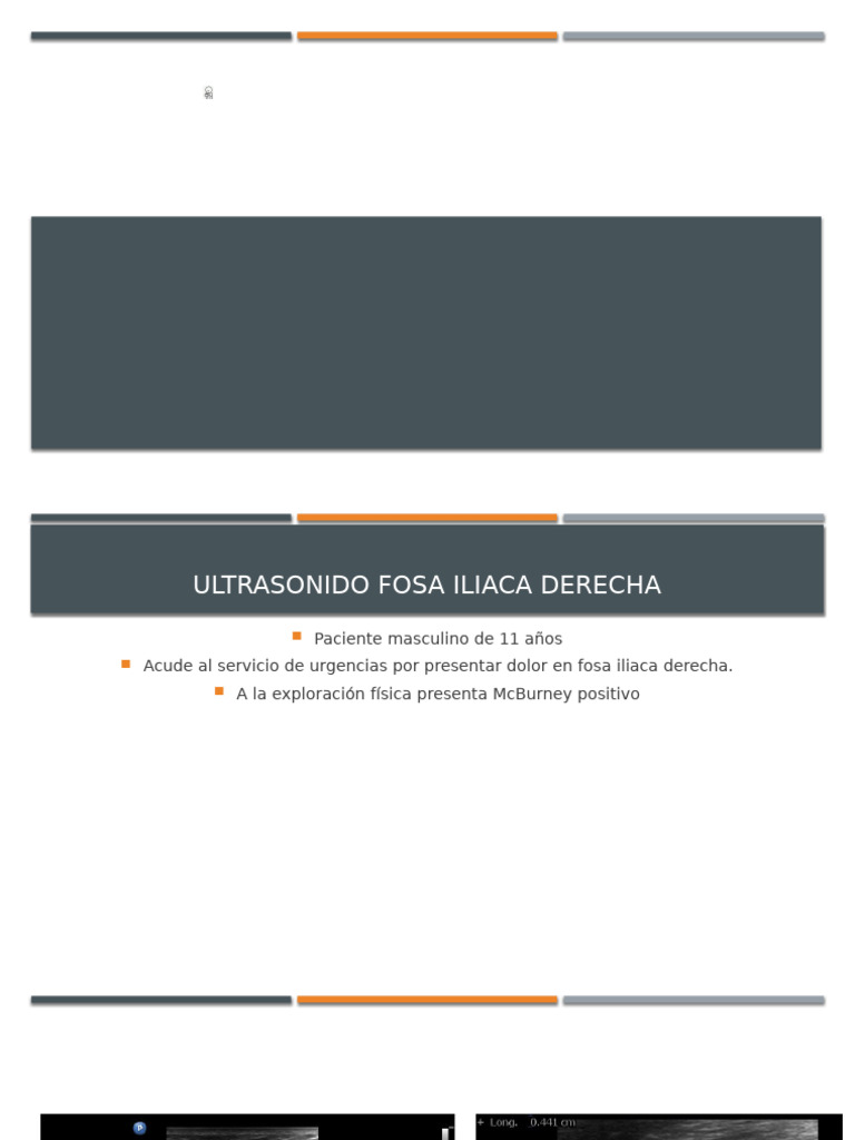Ultrasonido en Urgencias: Apendicitis y FAST | PDF | Ultrasonido | Abdomen