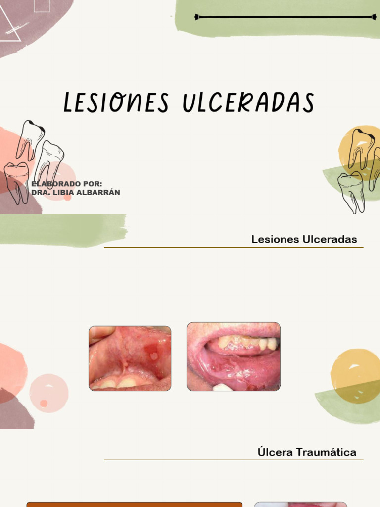Dra. Libia Lesiones Ulceradas | PDF | Inflamación | Especialidades Medicas
