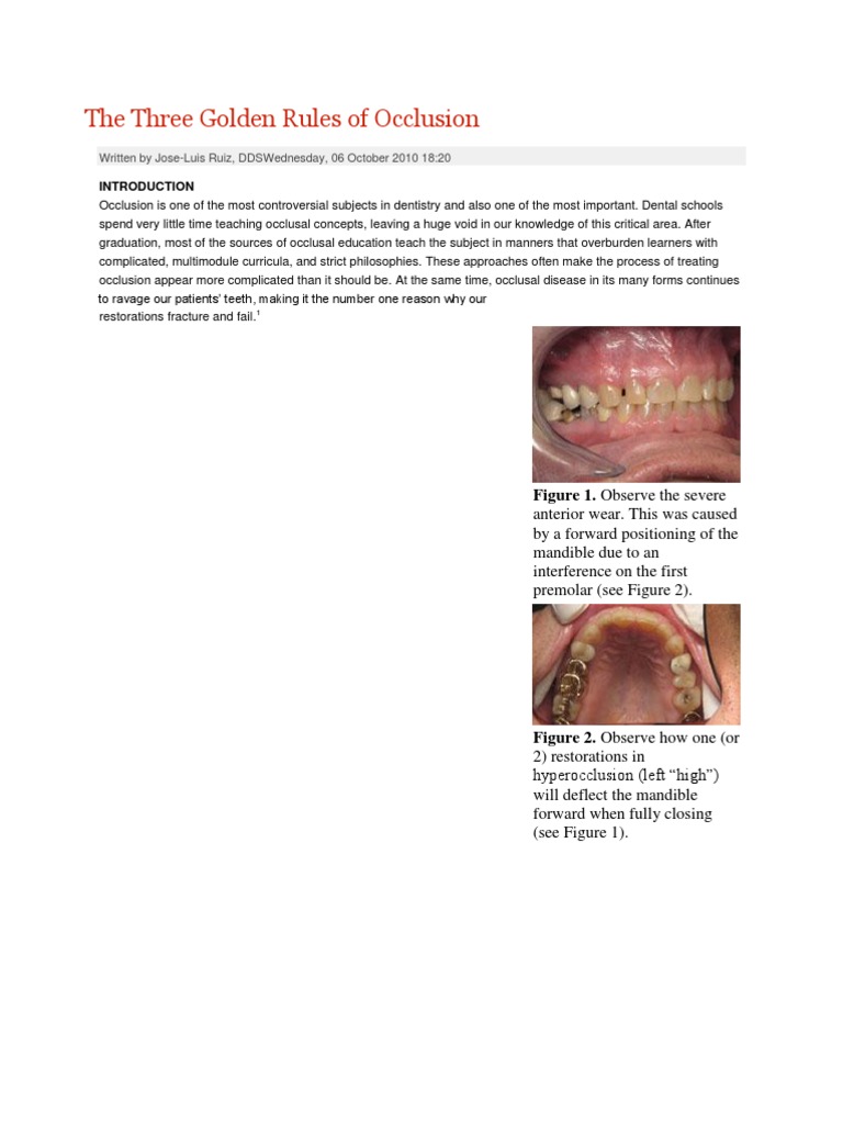 3 Golden Rules of Occlusion | PDF | Dentistry | Tooth