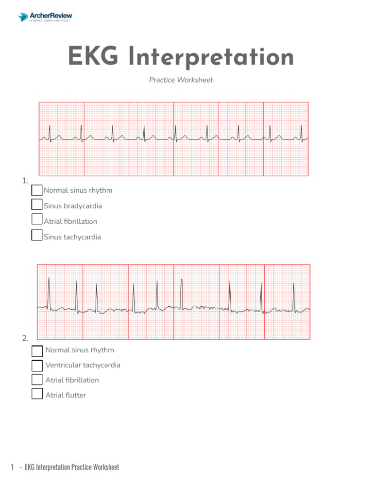 EKG Interpretation: Practice Worksheet | PDF | Electrocardiography ...