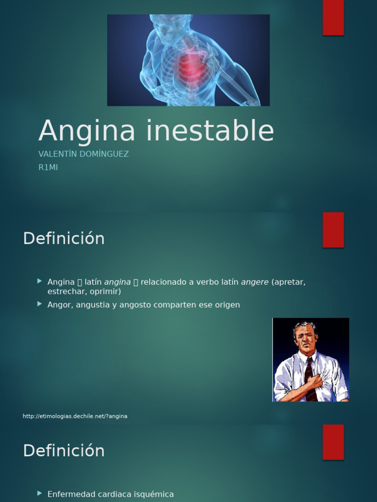 Angina Inestable | PDF | Enfermedades vasculares | Medicina Interna