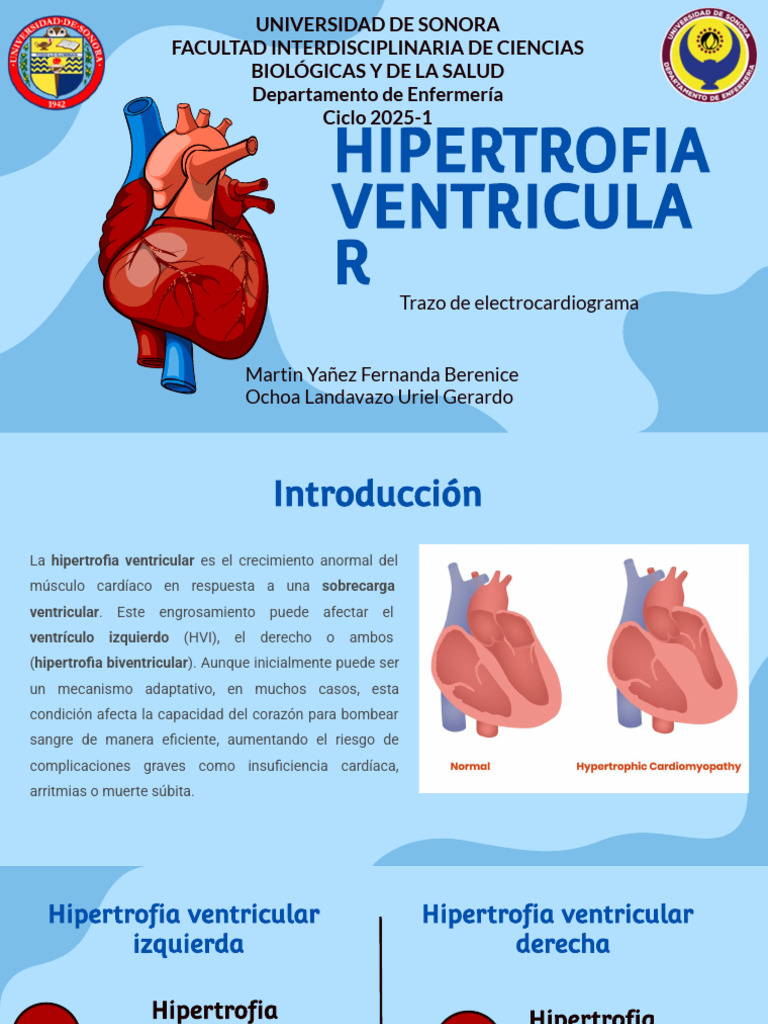 Hipertrofia Ventricular | PDF | Corazón | Sistema cardiovascular