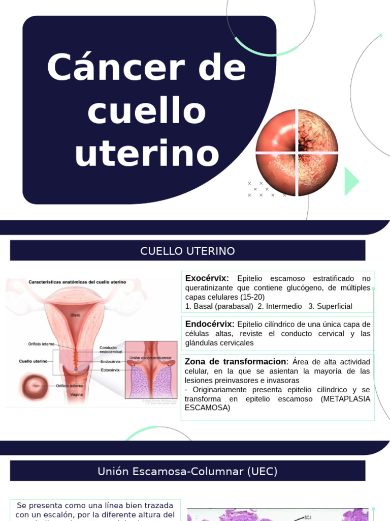 Cancer de Cuello Uterino CVP | PDF | Cáncer de cuello uterino | Especialidades Medicas