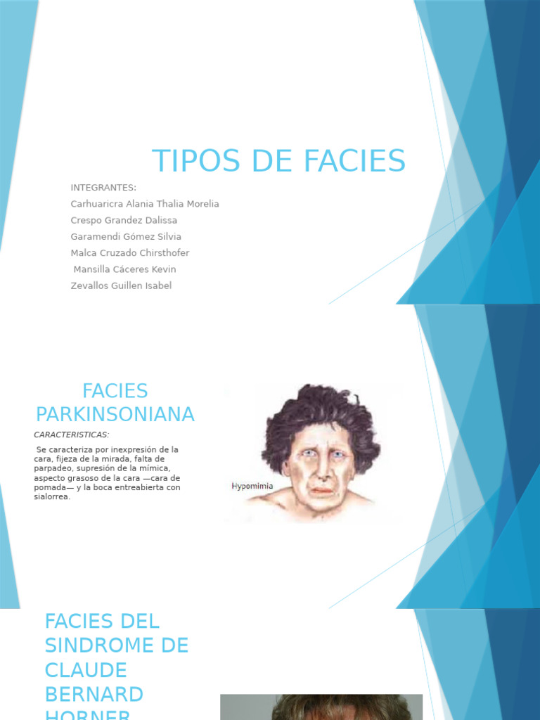 Tipos de Facies | PDF