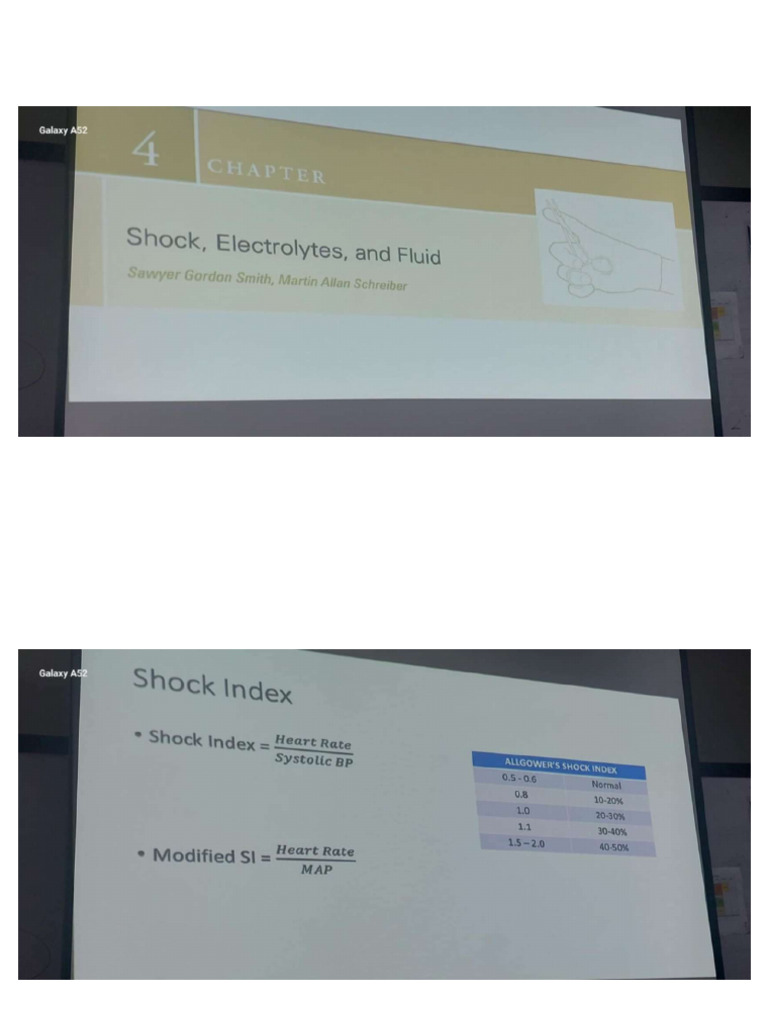 Shock | PDF
