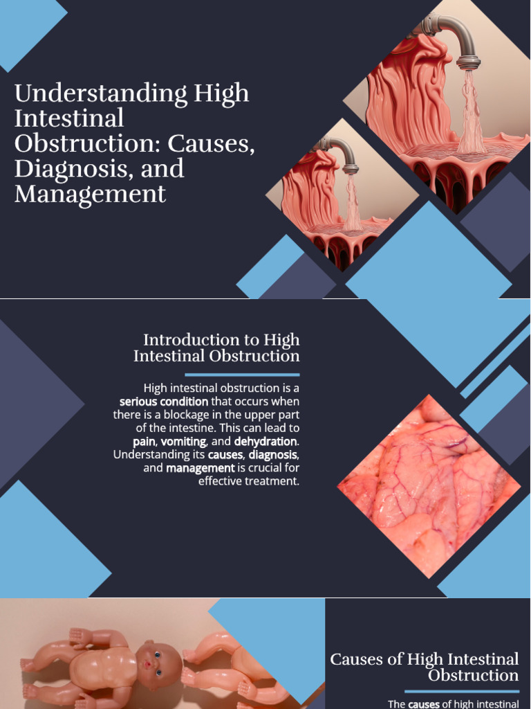 Wepik Understanding High Intestinal Obstruction Causes Diagnosis and ...