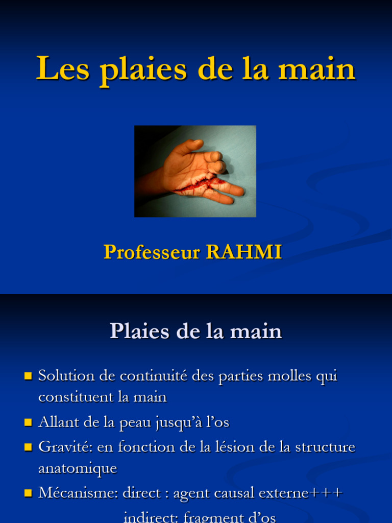 Plaies de la main : diagnostic et traitement | PDF | Main | Membres ...
