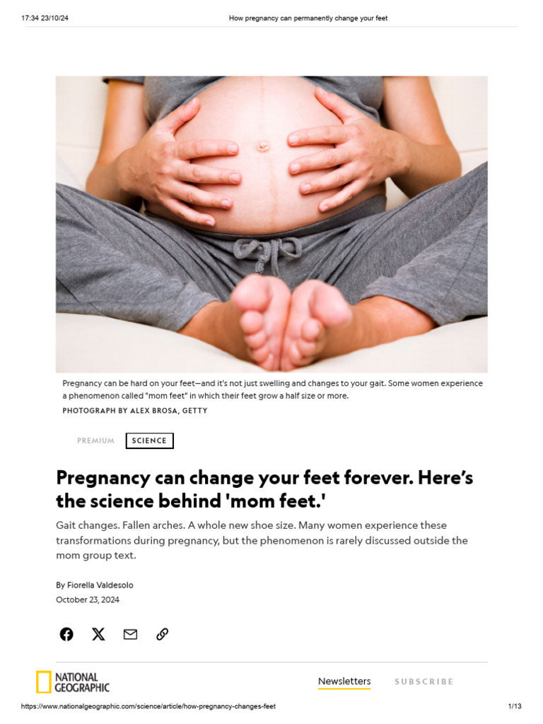 How Pregnancy Permanently Changes Feet | PDF | Edema | Foot