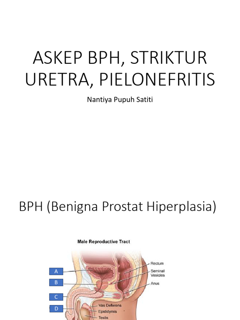 ASKEP BPH, STRIKTUR URETRA, PIELONEFRITIS (Autosaved) | PDF