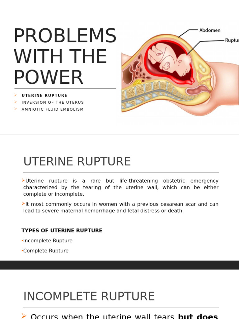 Problems With The Power | PDF | Uterus | Childbirth