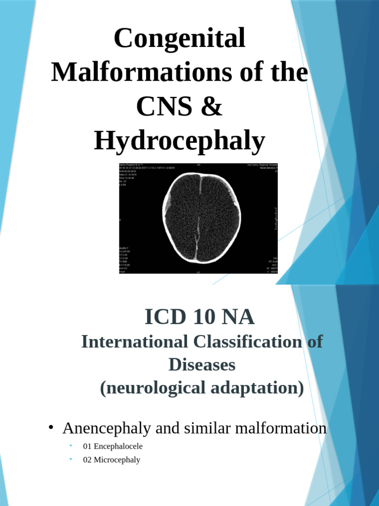 CNS Malformations and Hydrocephaly ICD-10 | PDF | Cerebrospinal Fluid ...