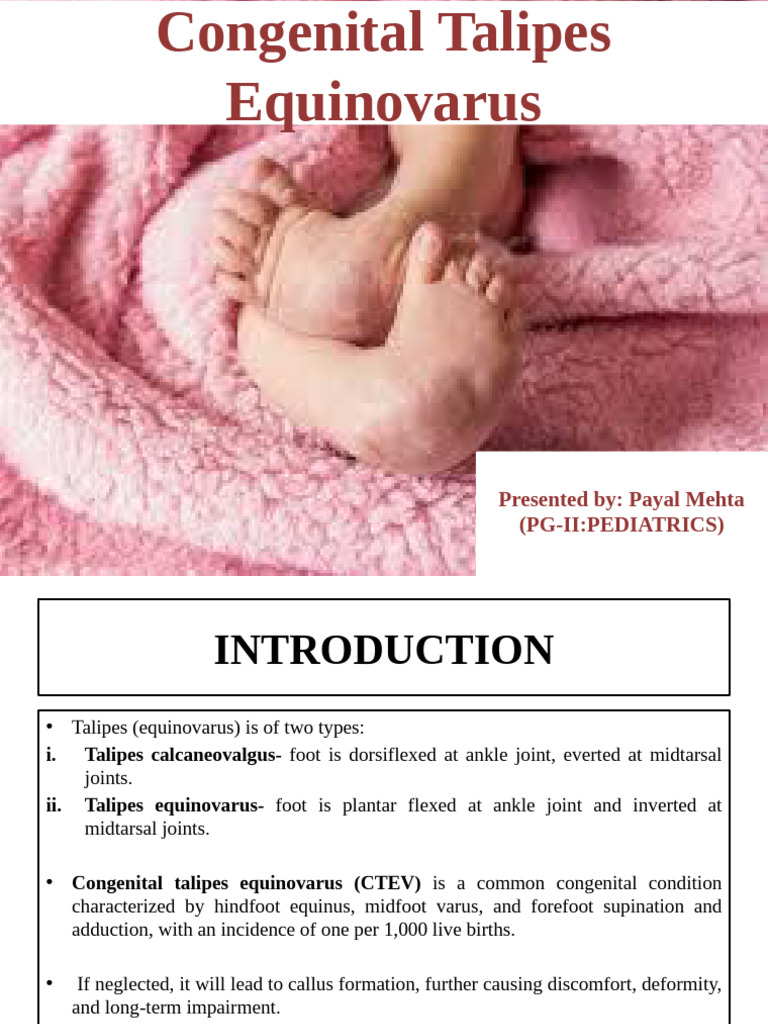 Congenital Talipes Equinovarus (CTEV) | PDF | Foot | Lower Limb Anatomy