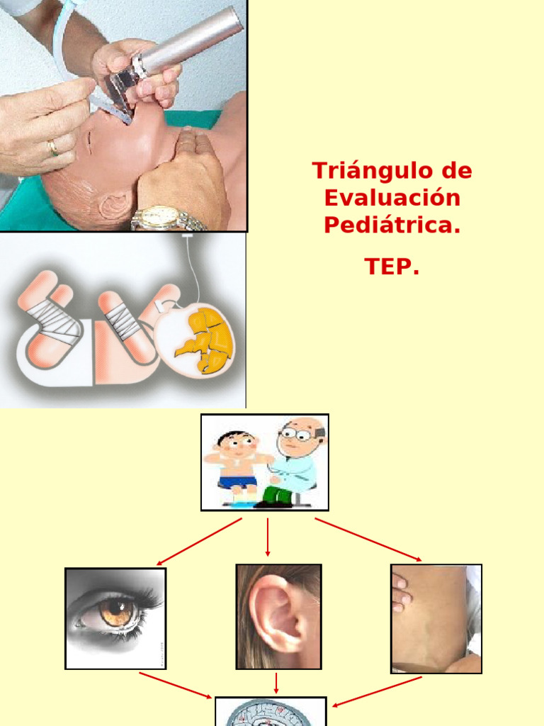 Triángulo de Evaluación en Urgencias Pediátricas | PDF | Choque ...