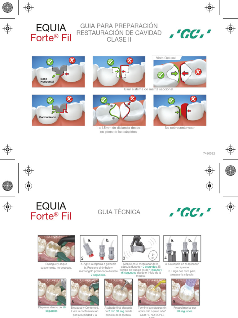 GCA - EQUIA - Forte - HT - Guia Tecnica - Es | PDF
