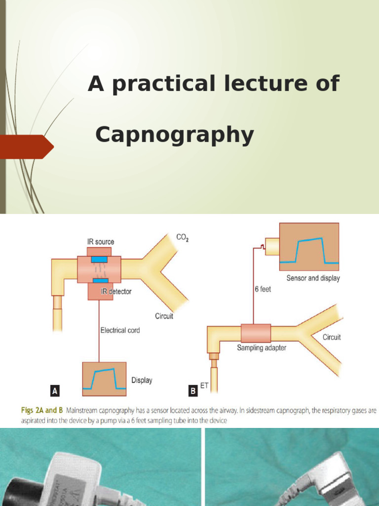 A Practical Lecture of Capnography | PDF | Breathing | Clinical Medicine