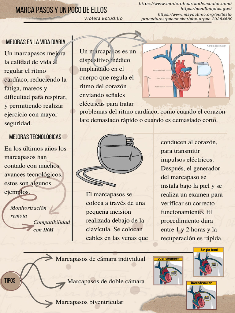 Marcapasos: Tipos y Beneficios Clave | PDF