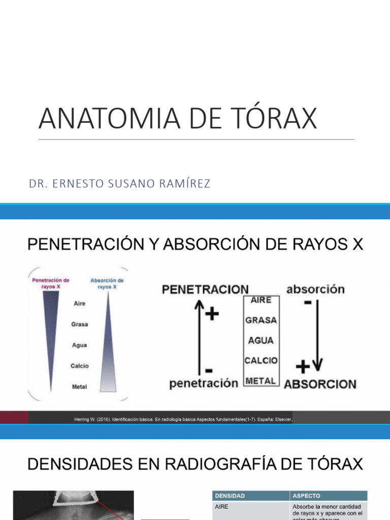 Anato RX TORAX | PDF | Pulmón | Tórax (anatomía humana)