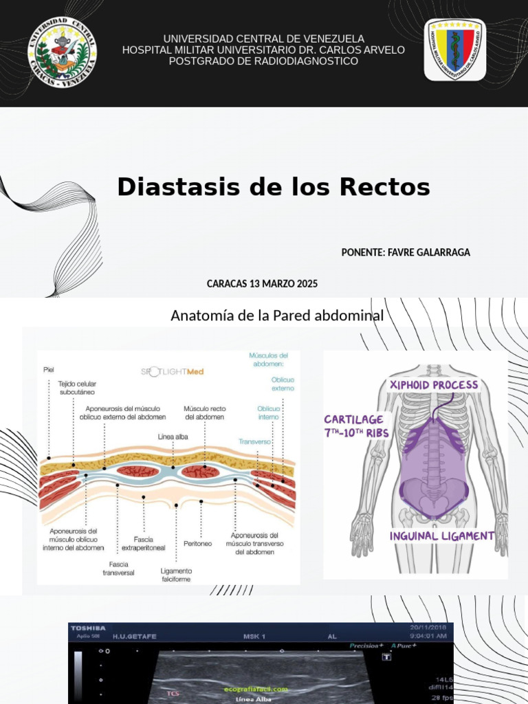 DIASTASIS DE LOS RECTOS FAVRE | PDF
