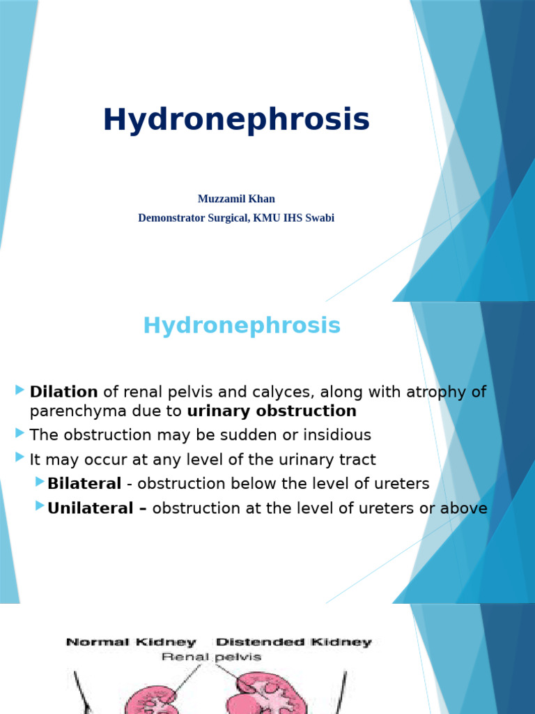 12. Hydronephrosis | PDF | Urinary System | Organ (Anatomy)