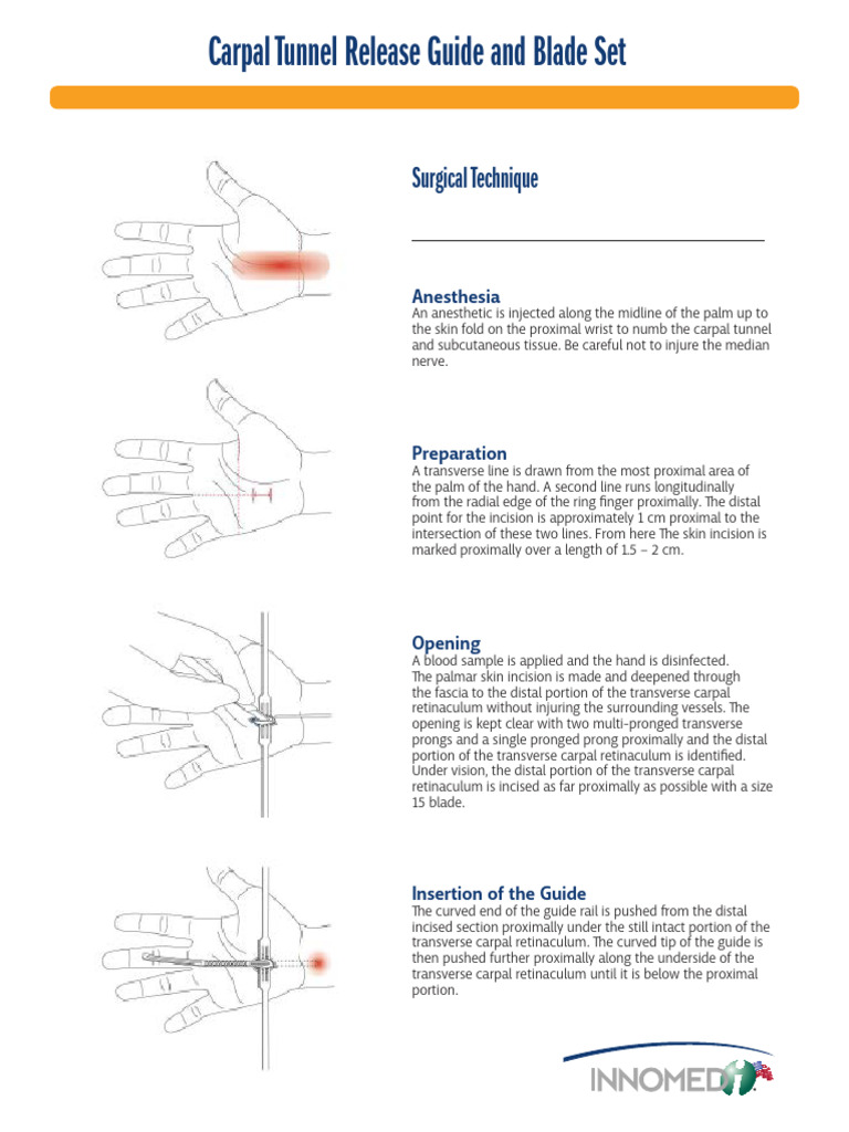 Carpal Tunnel Release Technique | PDF | Hand | Clinical Medicine