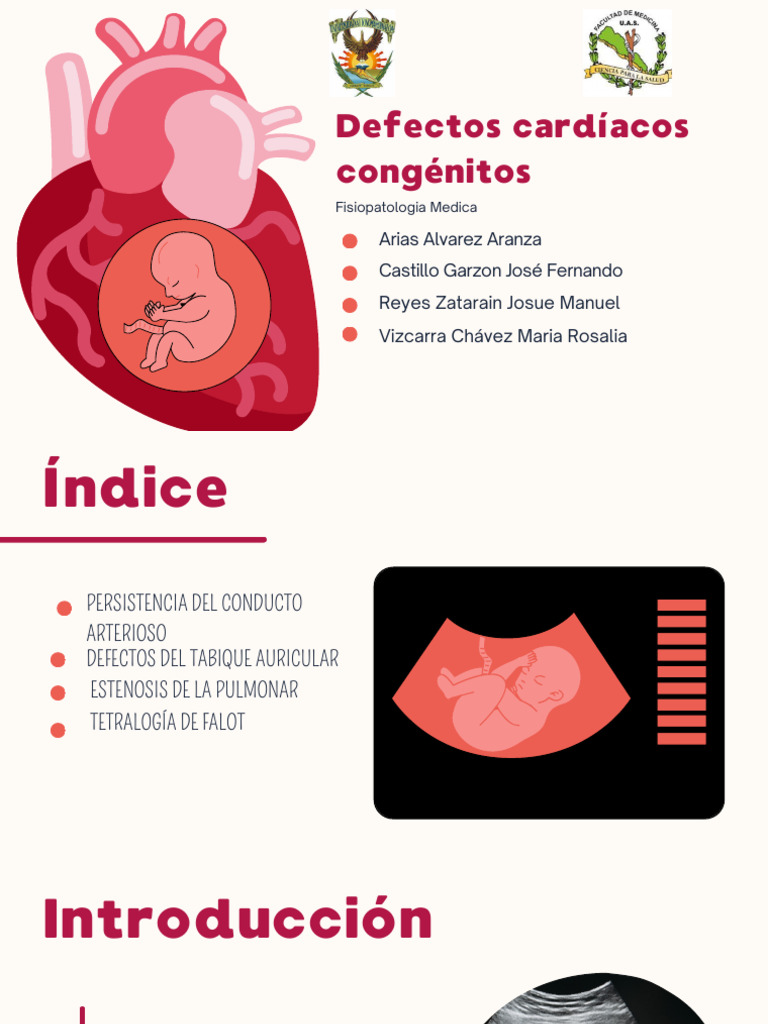 2 - Defectos Cardiacos | PDF | Corazón | Ventrículo (corazón)