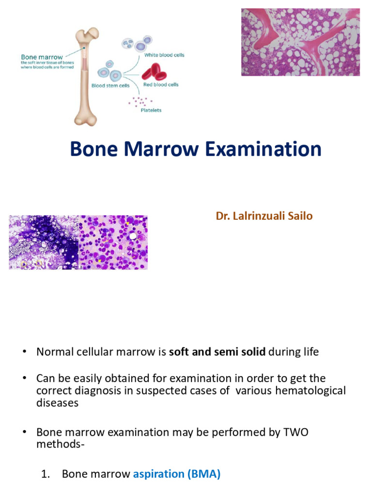 Bone Marrow Examination - For Notes | PDF | Bone Marrow | Anemia
