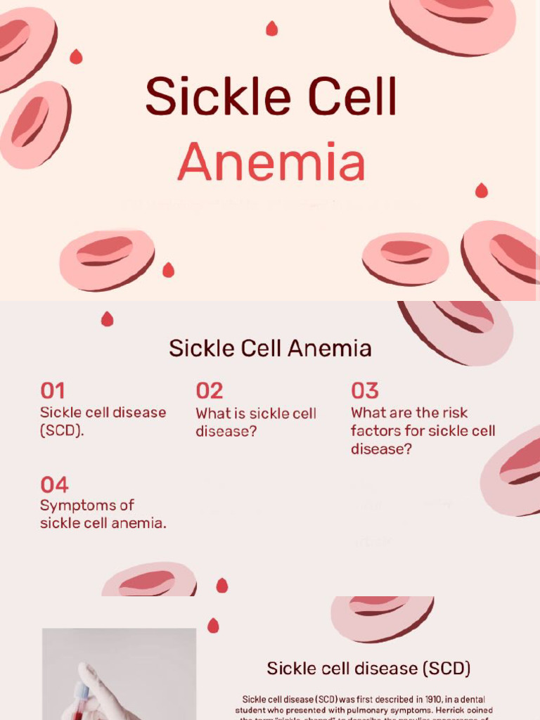 Sickle Cell Anemia | PDF