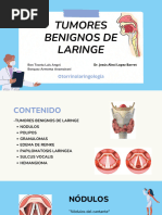 Nódulos y Pólipos Laríngeos: Guía Completa | PDF | Laringe | Anatomía ...